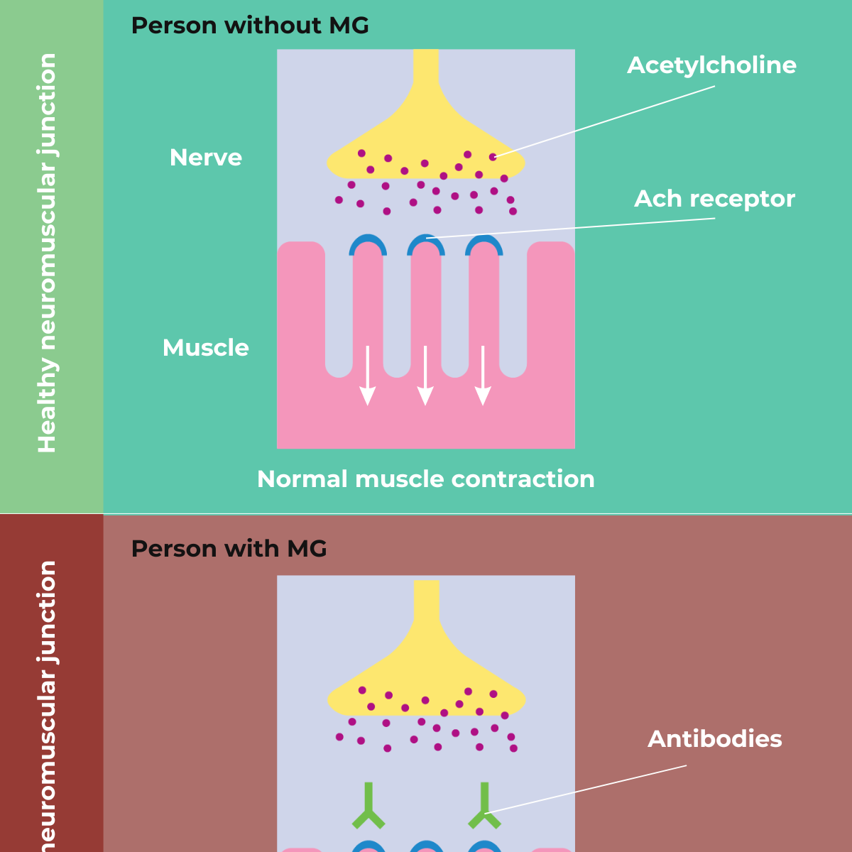 Acetylcholine Receptor Neuromuscular Junction