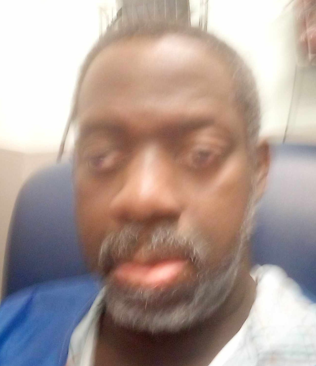 Look into his eyes: The success of my twin's ocular surgery