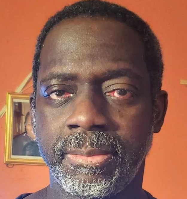 Look into his eyes: The success of my twin's ocular surgery